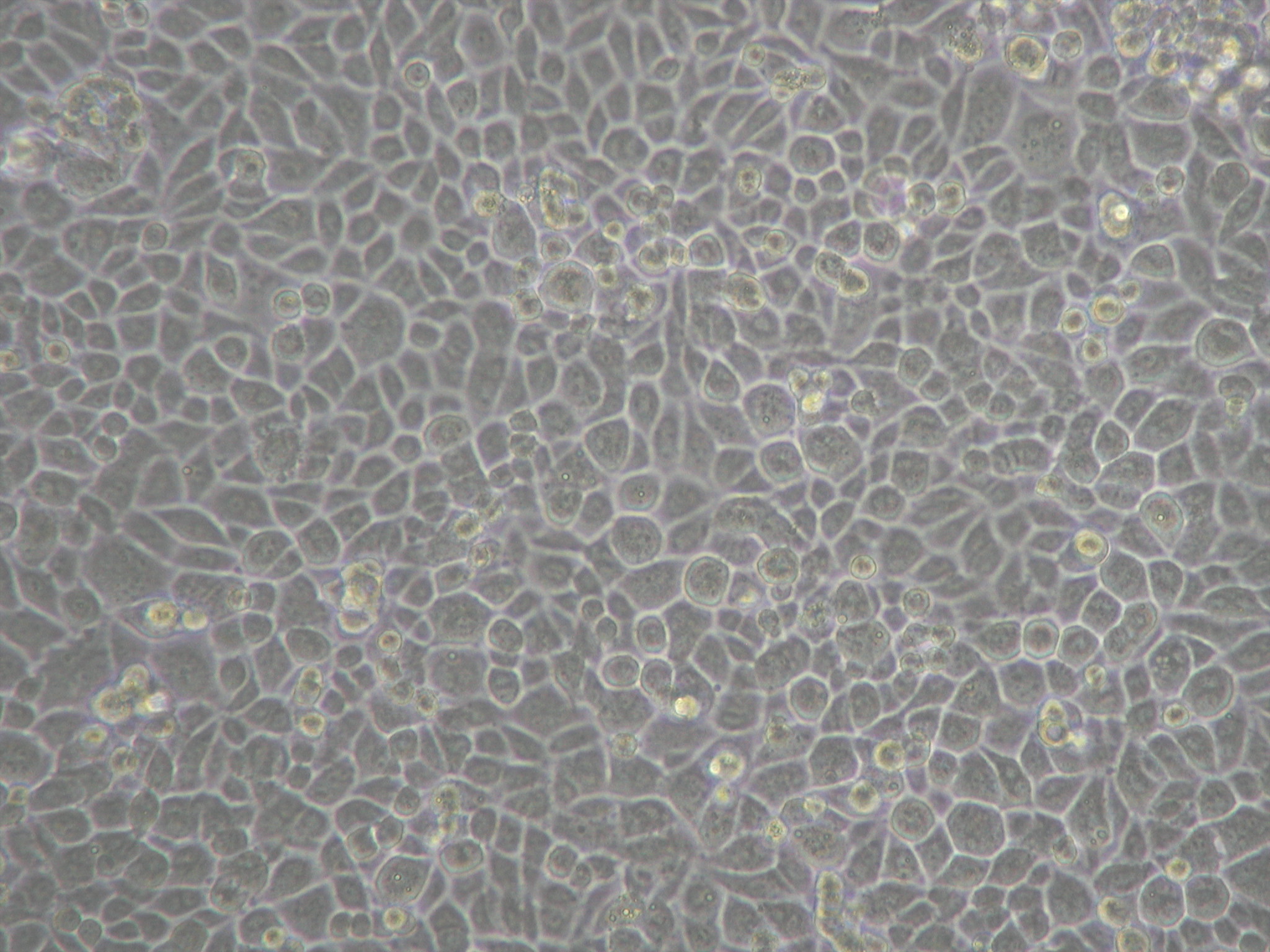 Cell Gallery | Fox Chase Cancer Center - Philadelphia PA