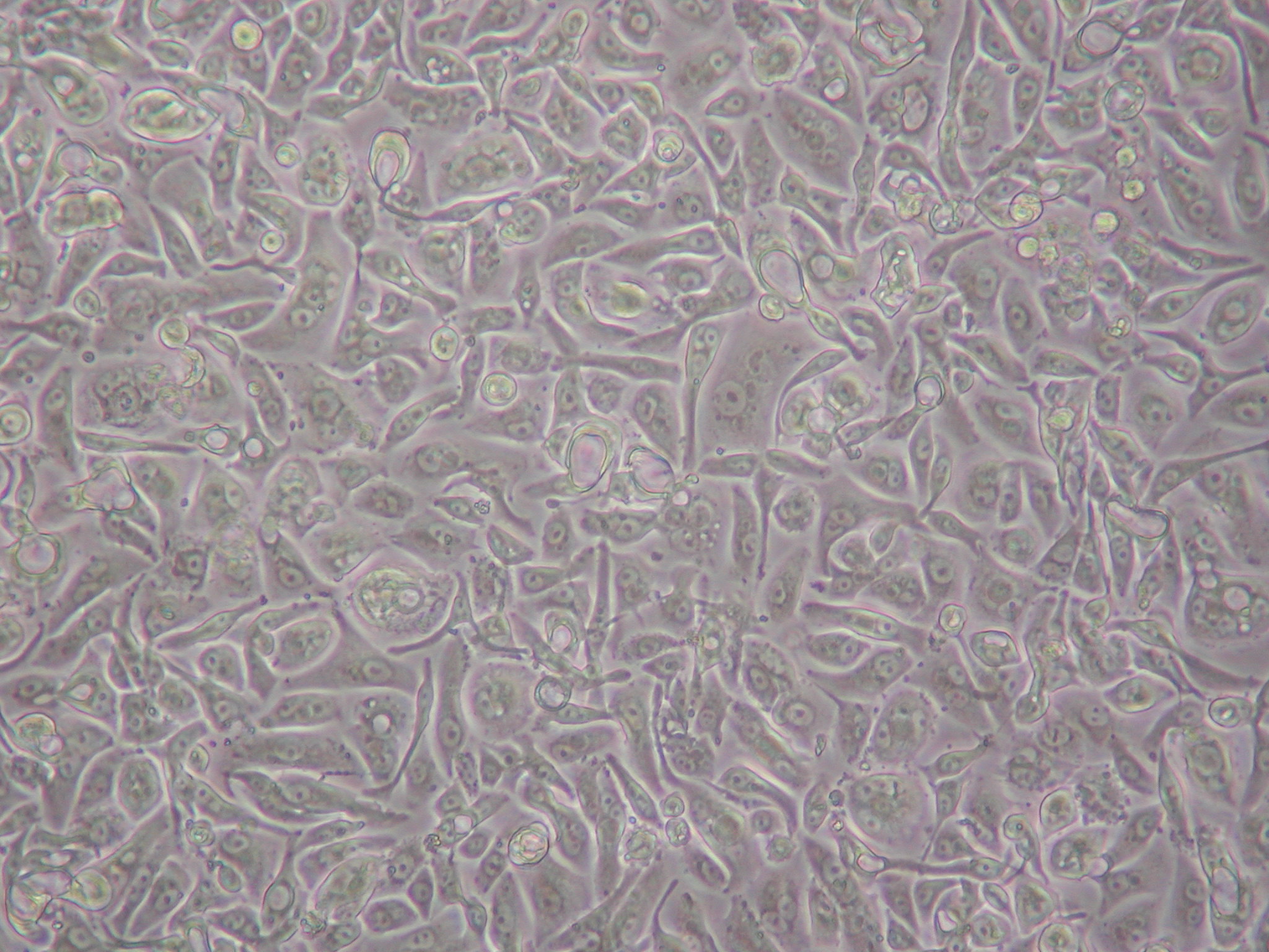 Cell Gallery | Fox Chase Cancer Center - Philadelphia PA