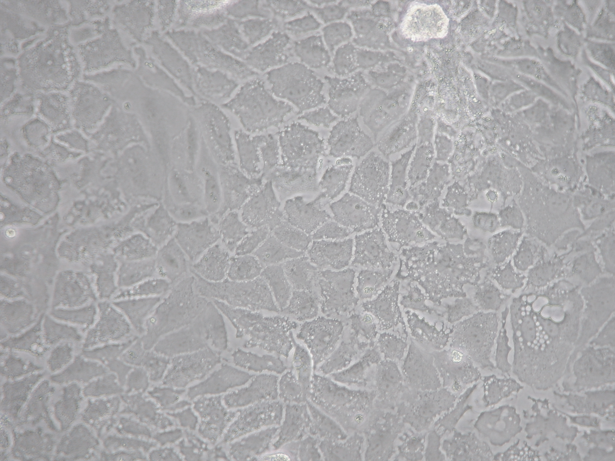 Cell Gallery | Fox Chase Cancer Center - Philadelphia PA