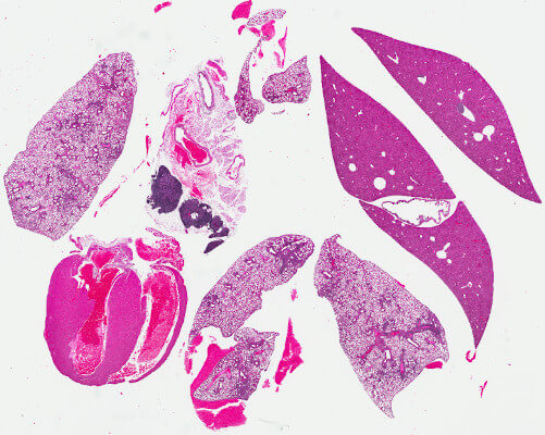 Services | Fox Chase Cancer Center - Philadelphia PA