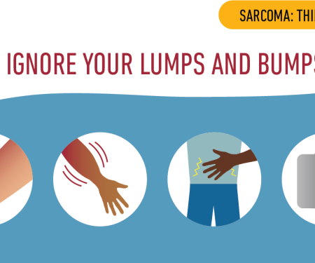 Sarcoma | Fox Chase Cancer Center - Philadelphia PA